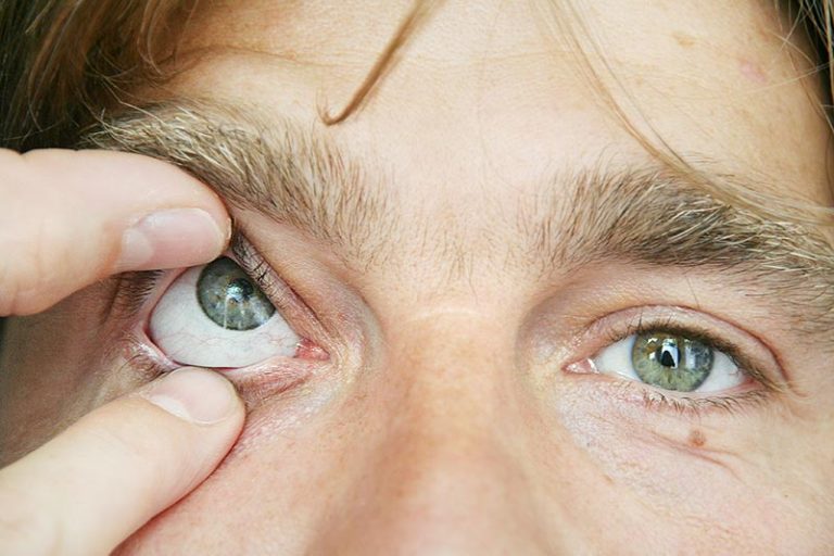 Verzorging | Haags Kunstogen Laboratorium